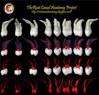 The Root Canal Anatomy Project: Maxillary Second Molar