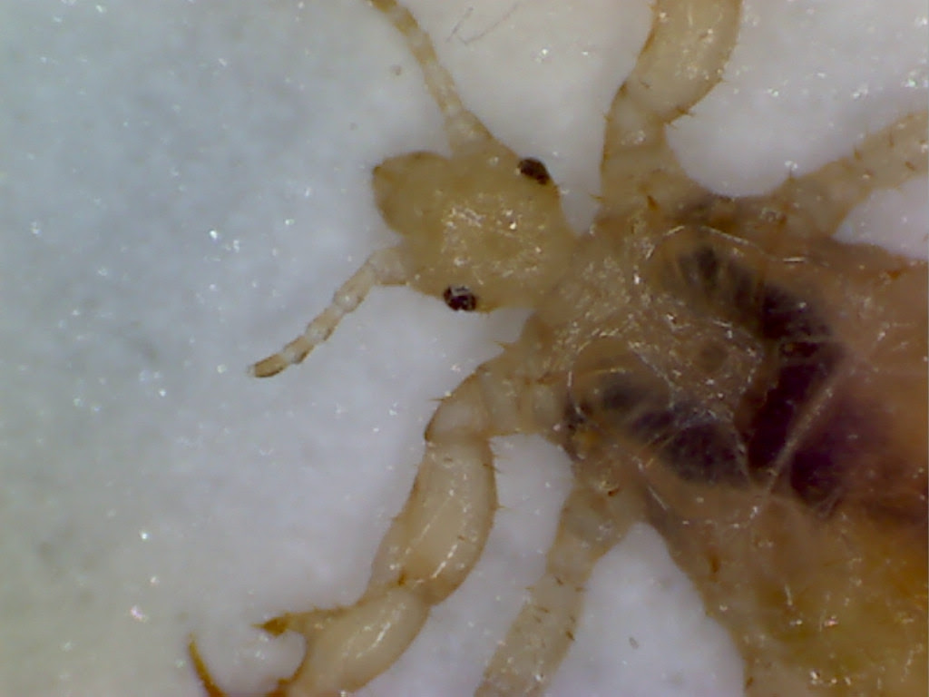 Bed Bug Eggs On Hair Bangdodo